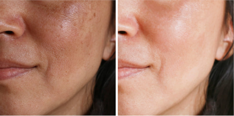 Cosmiatria | Instituto de Dermatologia